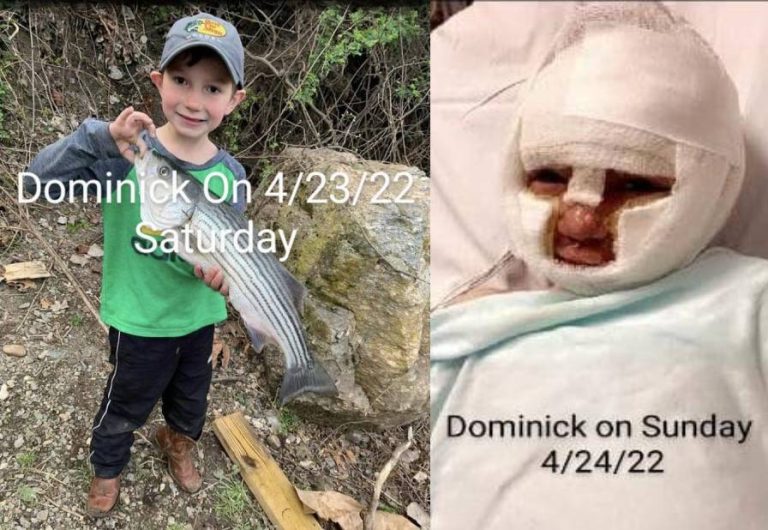 Dominic-before-and-after – DoingItLocal
